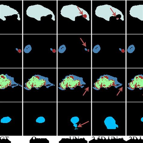 Visualization Of Segmentation Results Obtained By Different Methods For