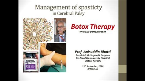 Botox Therapy Management Of Spasticity In Cerebral Palsy With Live
