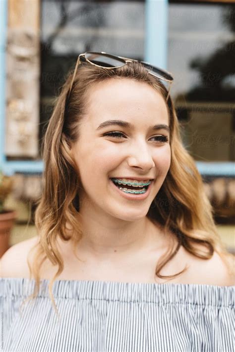 Braces Girls Cute Braces Adult Braces Chelsea Victoria Braces