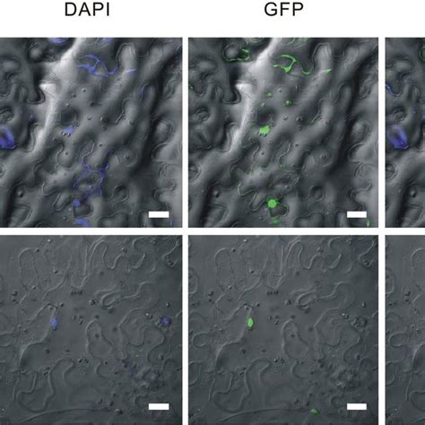 Subcelluar Localization Of Vanac26 In Tobacco Epidermis Nicotiana Download Scientific Diagram