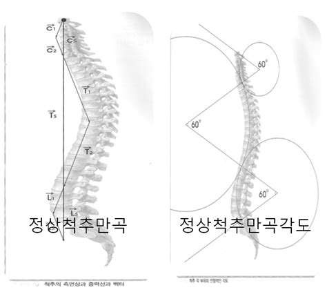 정상 척추 만곡 네이버 블로그
