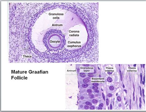 Ovary Pathoma Flashcards Quizlet