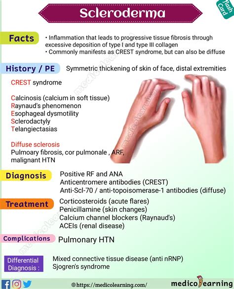 Know The Signs Artofit