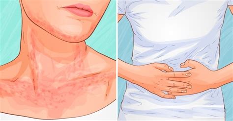 ორსულობის 10 ადრეული და ნაკლებად ცნობილი ნიშანი მათ შესახებ თითქმის არავინ იცის სასარგებლო