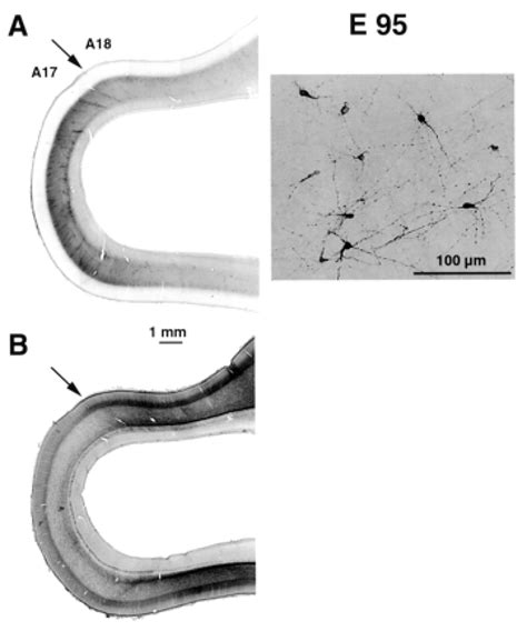 Identification Of Subplate And Areal Borders At E95 A Neuropeptide Y