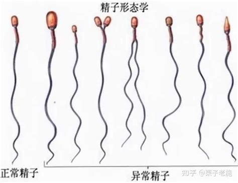 精液正常一般是什么颜色的什么才是正常标准 知乎
