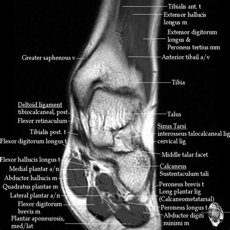 Peroneus Longus Mri Anatomy