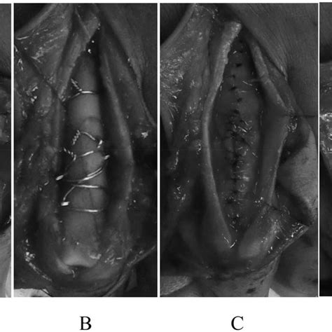 A After Longitudinally Splitting The Extensor Tendon The Periosteum Download Scientific