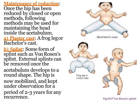 Congenitalhipdislocation 181019181229pptx