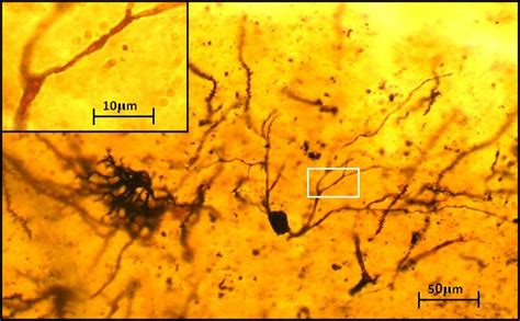 A Photomontage Of A Small Sized Aspiny Neuron Type Iii Green Arrow In