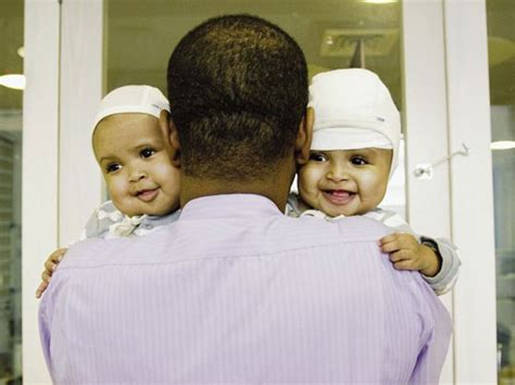 Ben Carson The Binder Twins Are They Still Alive Easy