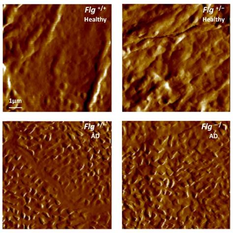 Representative Examples Of Morphological Modifications Of Corneocyte Download Scientific