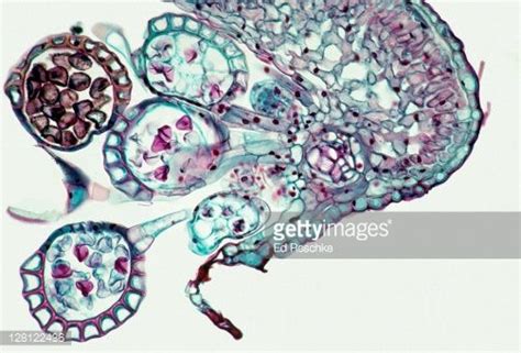 Fern Sori Microscope