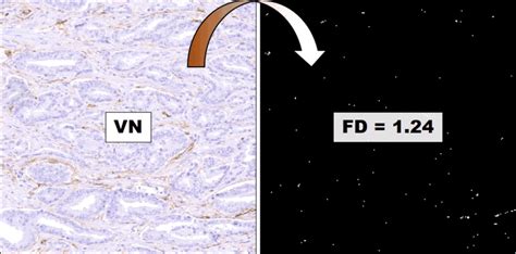 Determination Of Vascular Network Vn Architecture Fd Value On Download Scientific Diagram
