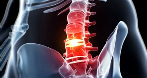 გამოიგონეს ალტერნატიული ხერხემალი