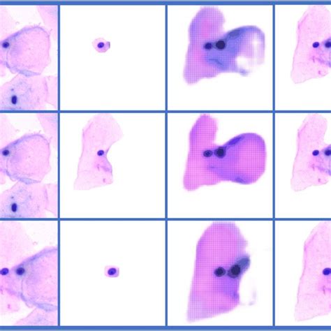 samples of overlapping cells segmentation due to the floating box