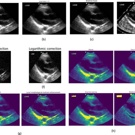 shows the evaluation result of various filters used as in sect 2 with
