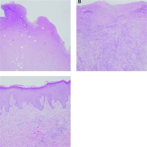 Outline Of Our Mapping Biopsy Method Download Scientific Diagram