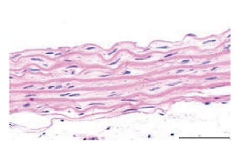 Hande Staining Of The Aorta In Rats 400x A Control Group B Vdn