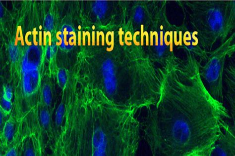 A Comprehensive Guide To Phalloidin Staining For Cytoskeleton