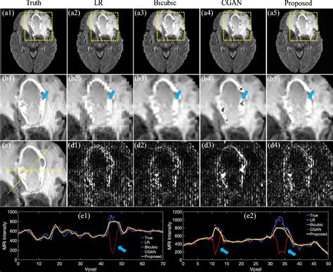 High Resolution Mri Synthesis Using A Data Driven Framework With
