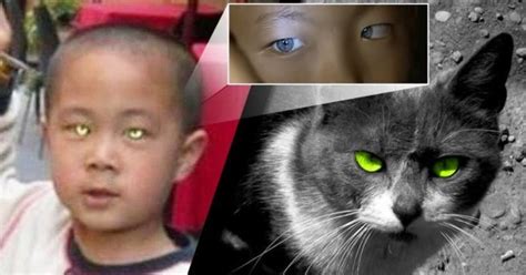 အပြာရောင်မျက်ဝန်းတစ်စုံနဲ့ ကောင်လေး Myanmarload