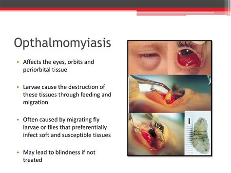 Ppt Myiasis Powerpoint Presentation Free Download Id4553666