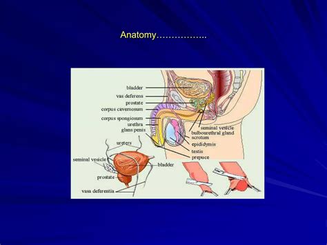 Congenitalanomaliesofurinarybladderppt