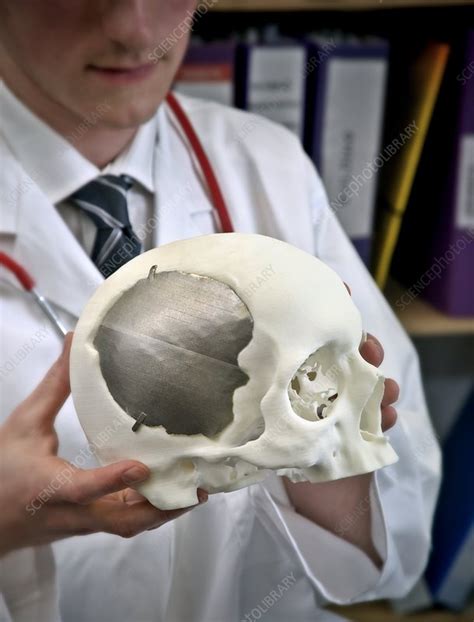 Skull Prosthesis Design Stock Image M6000412 Science Photo Library