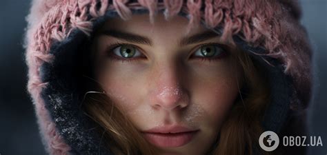 Як захистити шкіру від морозу поради дерматолога Oboz Ua