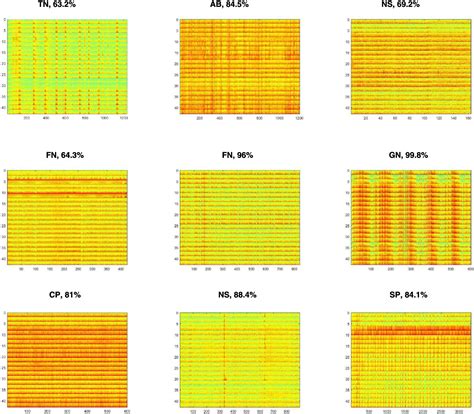 figure 5 from eeg based multi class seizure type classification using
