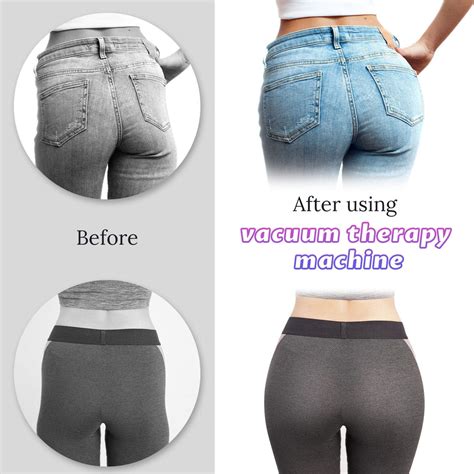 Butt Lift Machine Safe Non Invasive Vacuum Therapy