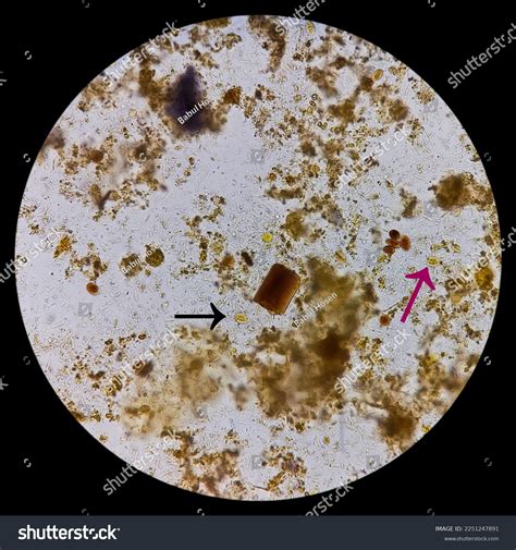 Stool Sample Giardia In Humans At Ana Means Blog