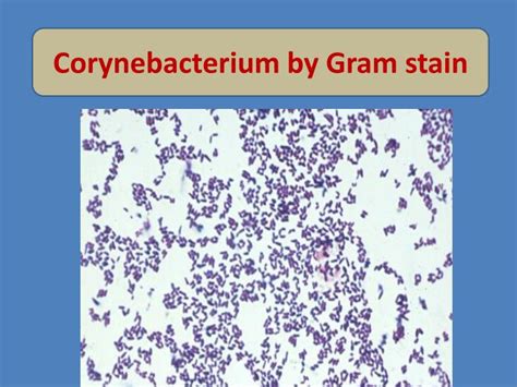 Ppt Corynebacterium Diphtheriae Powerpoint Presentation Id 3672369