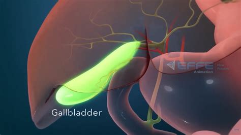 Laparoscopic Surgery Animation Service 3d Surgical Visuals