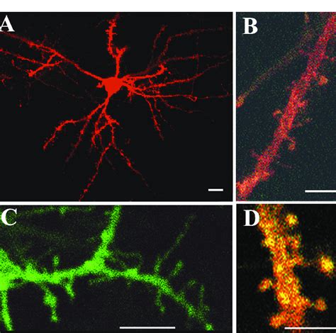 Neuronal Elements Of The Kitten Visual Cortical Labeled With Lipophylic Download Scientific
