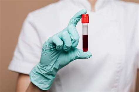 Cholesterol Hdl Ratio Test An In Depth Guide Lab Tests App