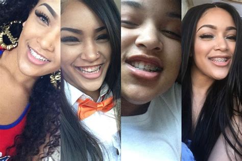 My Weird Braces Experiencejourney Faqs Youtube