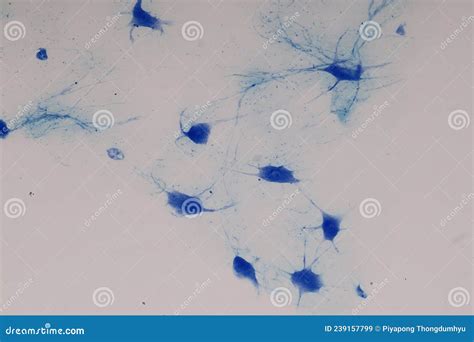 Neurones Moteurs Et Cellules Nerveuses Au Microscope Image Stock