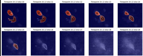 Estimating Cell Volumes After Cellpose Segmentation Image Analysis