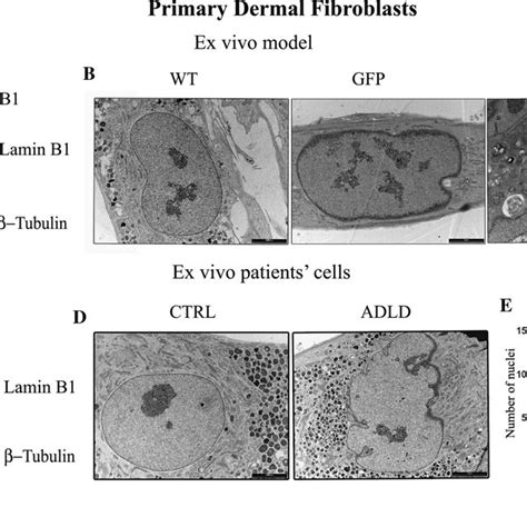 Ultrastructure Of Dermal Primary Fibroblasts Isolated From Download Scientific Diagram