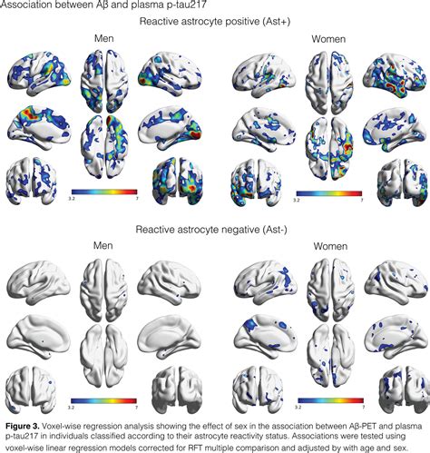 Sex Modulates The Role Of Astrocyte Reactivity In Preclinical Alzheimer