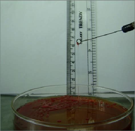 Positive String Test Mucoviscous String 5 Mm On Agar Plate