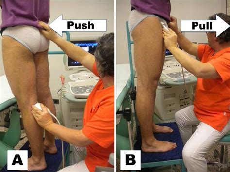 The Patient And The Operator S Positions For The Push Pull During Download Scientific