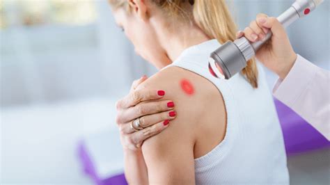 Torn Rotator Cuff Laser Therapy Offers A Gentle Fix Rheinlaser