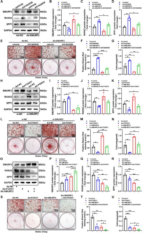 Foxo1 Regulates Runx2 Ubiquitination Through Smurf2 In Calcific Aortic