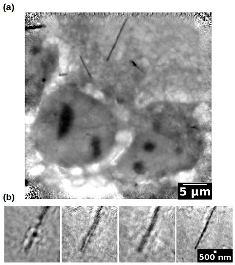 Automatic Differentiation For Inverse Problems In X Ray Imaging And Microscopy