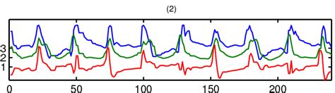 The Three Accelerometer Signals Captured From A Wii Controller While Download Scientific The Three Accelerometer Signals Captured From A Wii Controller While Download Scientific