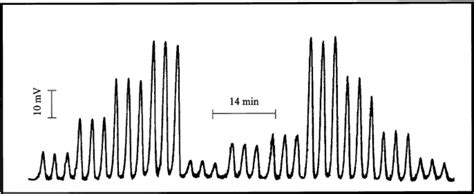 Sequential Injection Recordings Obtained From Urea Determination In Download Scientific Diagram