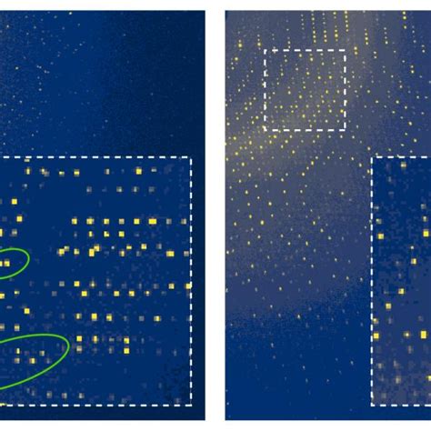 Topic Linac Coherent Light Source Lcls Slac National Accelerator Laboratory